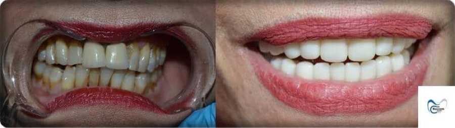 Center Doctor Bassem Samir Dentist | Vezeeta.com