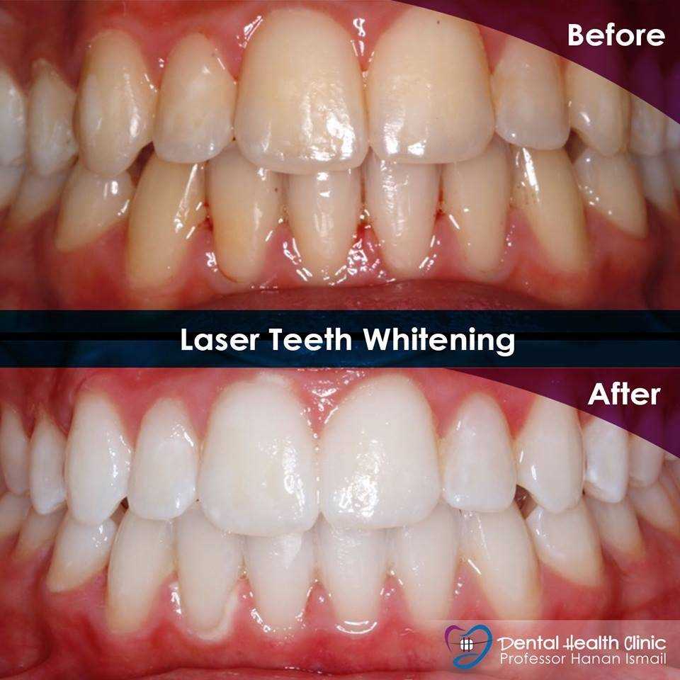 احجز مع دكتورة حنان اسماعيل أستاذ اسنان | فيزيتا