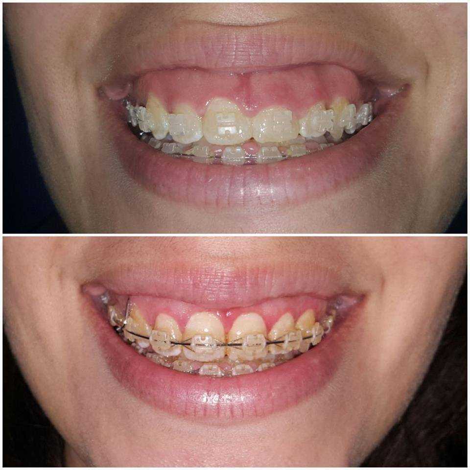 احجز مع دكتورة حنان اسماعيل أستاذ اسنان | فيزيتا