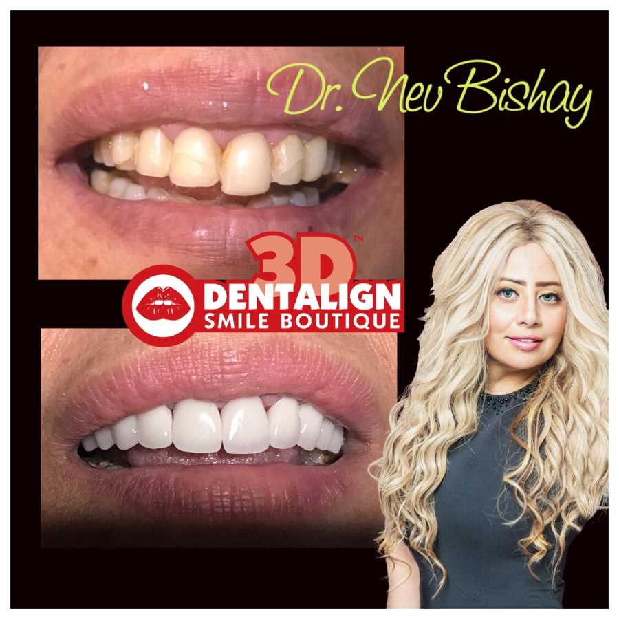 احجز مع دكتورة نيفين بشاي استشاري اسنان | فيزيتا